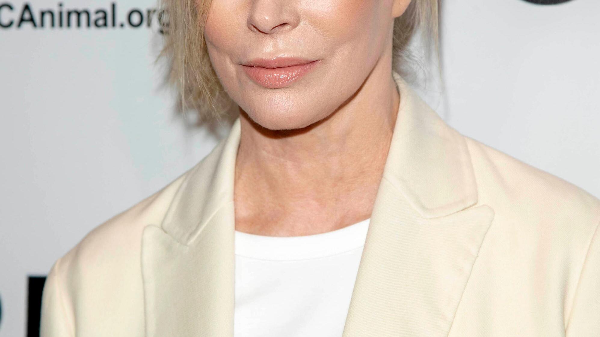 Kim Basinger Plastische Chirurgie 2024